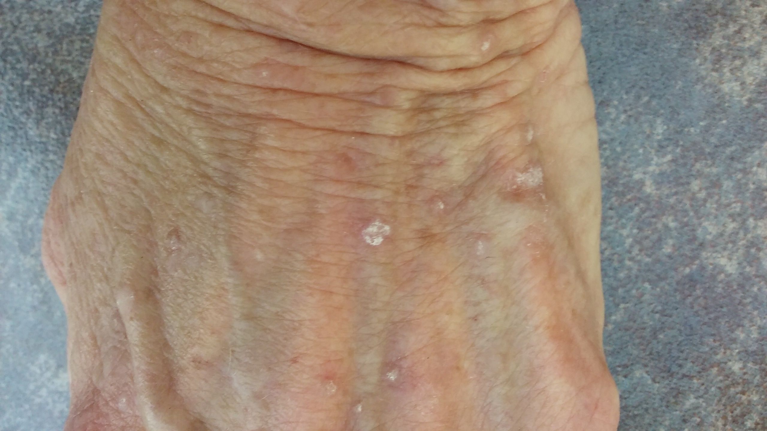 Skin problem - Blogs & Forums