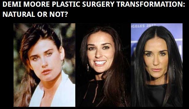 "Plastic Surgery" Before and Afters - Blogs & Forums