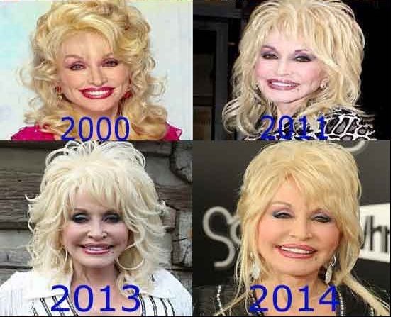 "Plastic Surgery" Before and Afters - Blogs & Forums